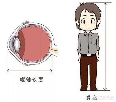 专家揭秘青少年近视能否被治愈？ 知乎