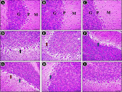 Histopathological Examination Of The Cerebellum Was Conducted In