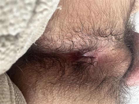 Hairy Hole Nude Pics Xhamster