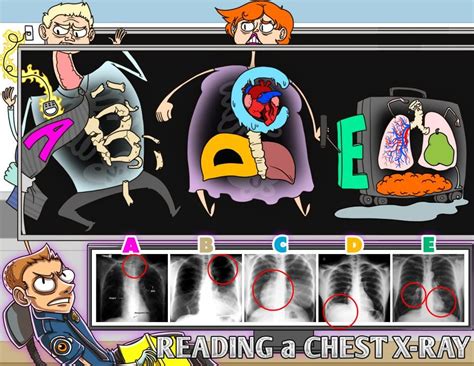 Reading A Chest X Ray Osmosis