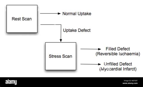A Cardiac Stress Test Is A Medical Procedure Used To Assess The Hearts Response To Physical