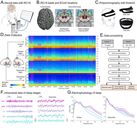 Fahim Anjum On Linkedin Parkinsonsdisease Sleepresearch