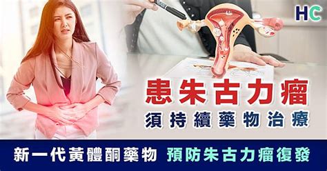 【長期經痛】患朱古力瘤須持續藥物治療！新藥預防朱古力瘤復發 Health Concept Line Today