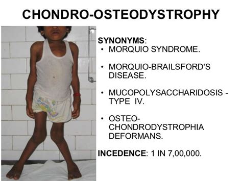 Morquio Syndrome