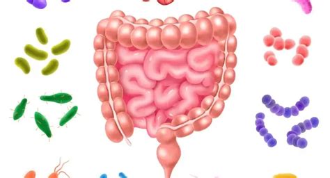 Helminthiasis Sintomas Sanhi Medikoph