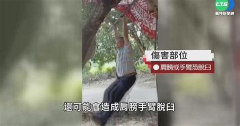 拉單槓舒緩 坐骨神經痛 醫 恐導致受傷