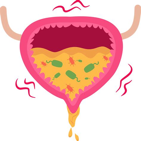 Urinary Tract Infection 53761458 Png