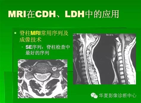 文章详情