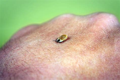 Sintomas tratamento e prevenção da infecção transmitida por carrapatos
