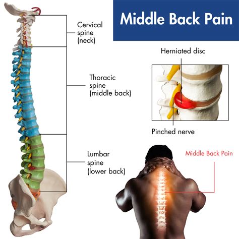 Middle Back Pain Treatment In Madison Middle Back Pain Specialists