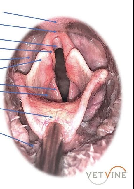 Epiglottis Id Diagram Quizlet