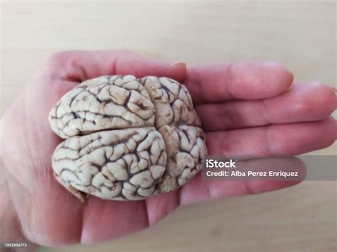 Performing A Lamb Brain Dissection At Online University In Time Of