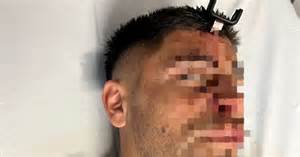 Conmoción En El Fútbol En Medio De Una Pelea Le Clavaron Una Llave En La Cabeza A Un Jugador