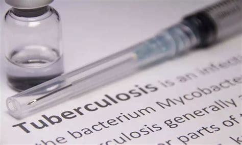 बीपीएस कॉलेज में विश्व टीबी दिवस मनाया गया World Tb Day Observed At