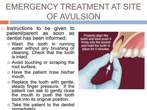 Treatment Of Traumatized Teeth Pptx