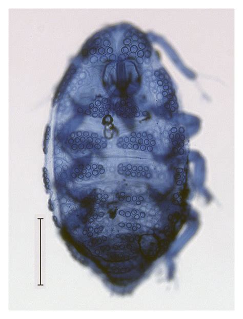 Nymphs Of Neothoracaphis Glaucae A First Instar Nymph To Be Aptera Download Scientific