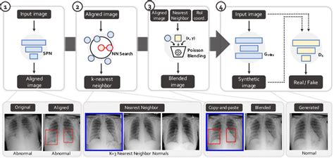 Figure 1 From Generative Residual Attention Network For Disease Detection Semantic Scholar