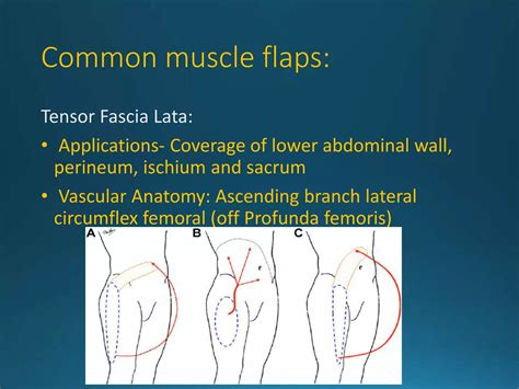 Flaps In Surgery Pptx