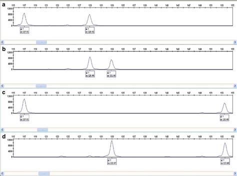 Capillary Electrophoresis Ce Analysis Of Str 84 For The Affected