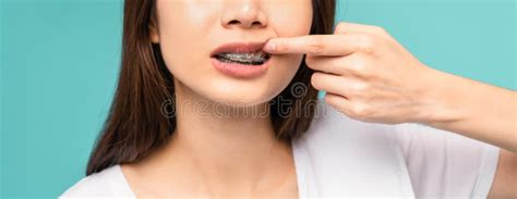 Woman Wearing Braces With Sensitive Teeth And Hands Touch The Cheeks On