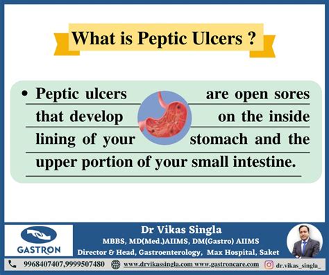About Peptic Ulcers Gastron