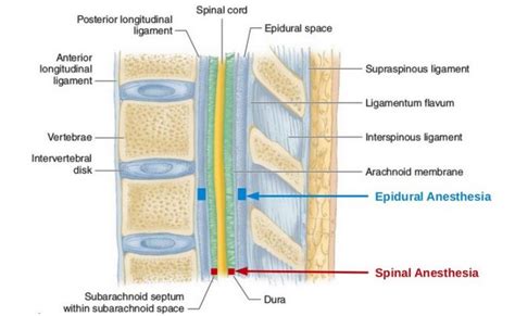 Anestesi Spinal Fungsi Prosedur Dan Risikonya Idn Medis