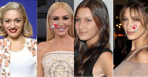 Celebrity Plastic Surgery 10 Before And After Pics Fly Fm