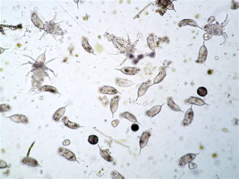 Pond Water Organisms Under Microscope