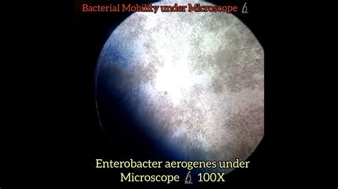 Enterobacter Aerogenes Under Microscope 🔬100x 450 10000x Bacteria