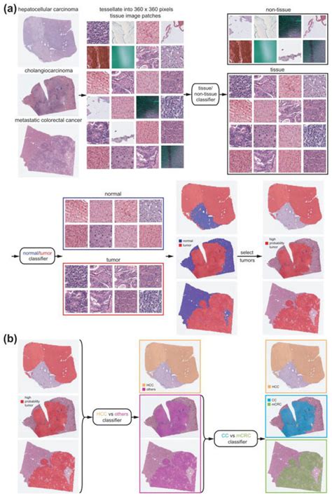 Cancers Free Full Text Deep Learning For The Pathologic Diagnosis