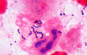 Streptococcus Anginosus