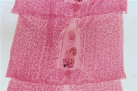 Monogeneans And Cestodes