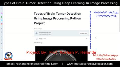 Types Of Brain Tumor Detection Using Deep Learning Brain Tumor Types Classification Using