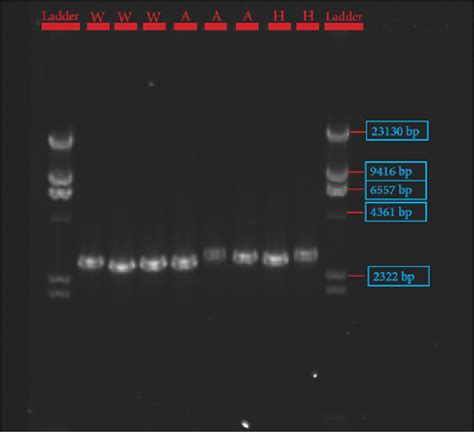 Figure 3 From Lipogenic Gene Single Nucleotide Polymorphic Dna Markers Associated With