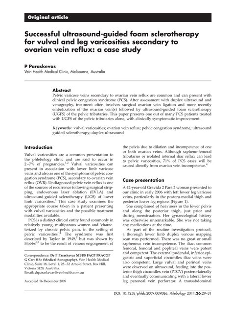 Successful Ultrasound Guided Foam Sclerotherapy For Vulval And Leg