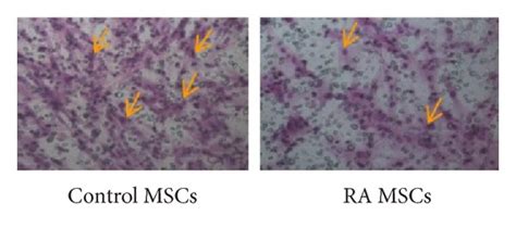 Proliferative Potential Cellular Apoptosis And Migration Ability Of Download Scientific