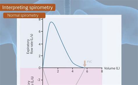 Spirometry Technique And Interpretation Alexander Street A Proquest Company