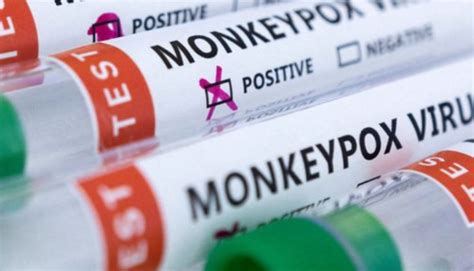 Oms Cree Que Viruela Del Mono Podría Transformarse En Una Enfermedad De