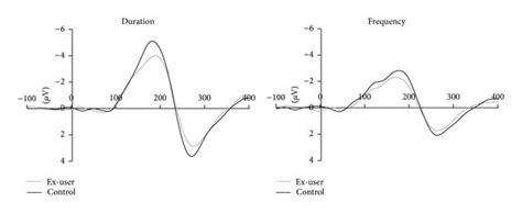 A Mismatch Negativity Mmn Waveforms At Fz Displayed For Each Download Scientific Diagram