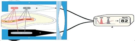 Journal Of Interdisciplinary Dentistry