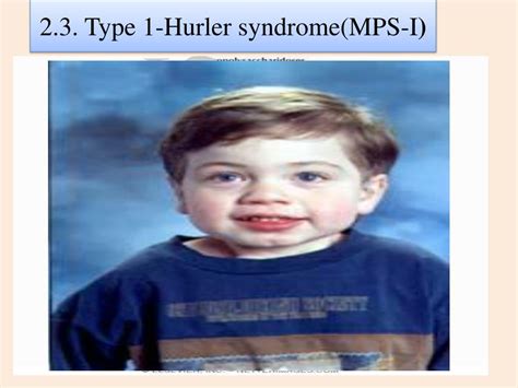Ppt Inborn Errors Of Metabolismiem Lecture 2 Powerpoint
