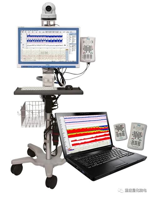 连续脑电图监测在神经重症疾病中的应用 疾病 癫痫发作 新浪新闻