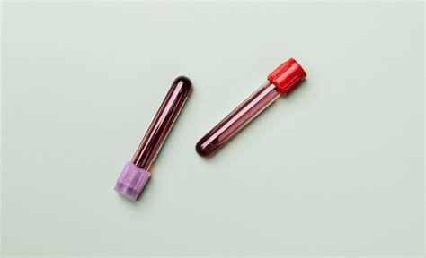 10 Cheapest Phlebotomy Classes And Training Programs