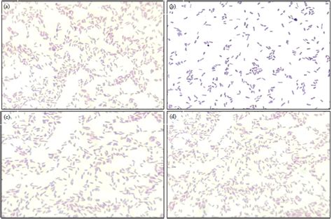 Pseudomonas Stutzeri Cm1 Novel Thermotolerant Cellulase Producing Bacteria Isolated From