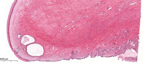 Cervix Histology Diagram