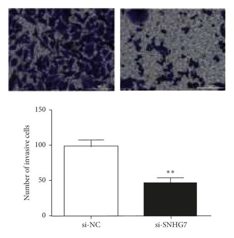 Snhg7 Knockdown Repressed Malignant Behavior Of Hs746 T Cells A