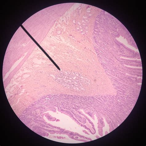 Duodenum Diagram Quizlet