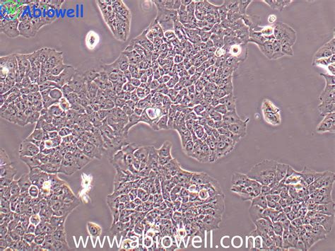 Hacat 人永生化表皮细胞 （str鉴定） 艾碧维生物官网