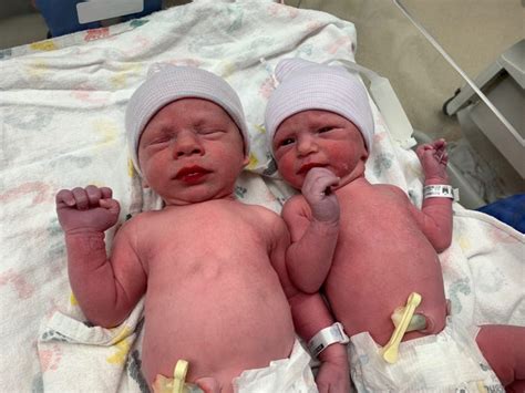 Twins Born 30 Years After They Were Frozen As Embryos