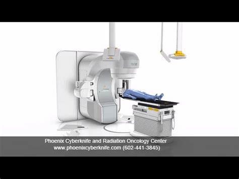 Trigeminal Neuralgia Treatment Phoenix Cyberknife Center